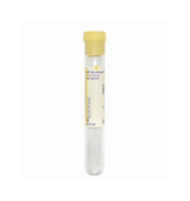 Vacutainer Urine Collection Kits: Urinalysis, Reduce the need to retest ...